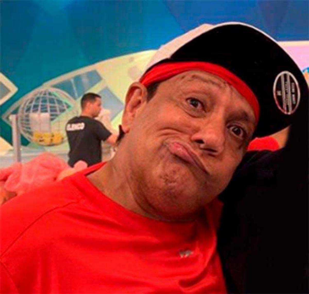 Liminha está otimista com tratamento para recuperar movimentos faciais ...