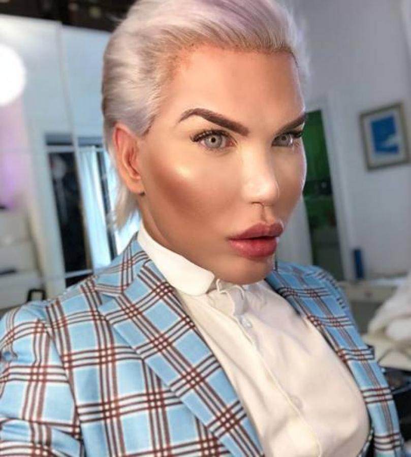 Ken Humano faz nova cirurgia e tira mais de 3 litros de gordura do ...