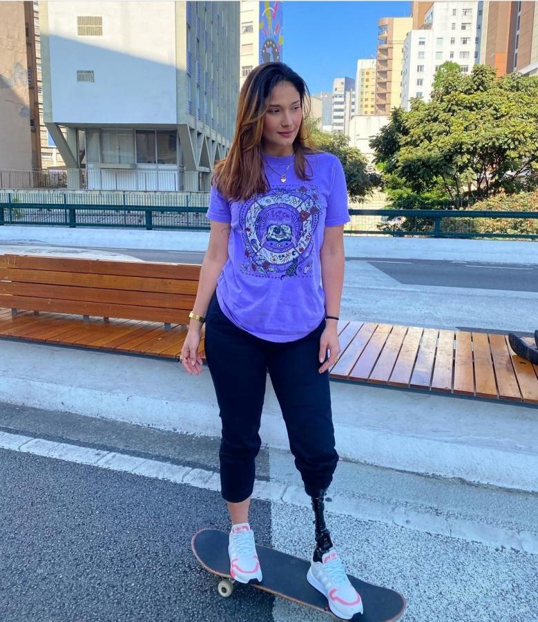 Modelo transforma dor em ajuda a pessoas amputadas | Gazeta Digital