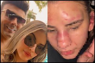 Apresentador é demitido após ser acusado de agredir esposa | Gazeta Digital